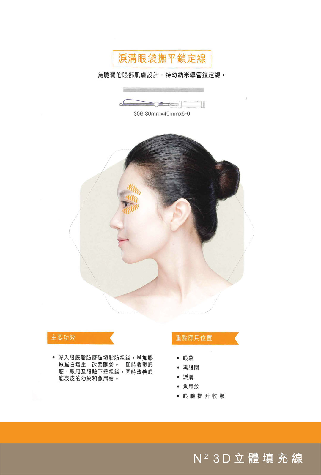 韓國納米收緊線 N-Finders PDO Thread - NuMe Day Procedure Center